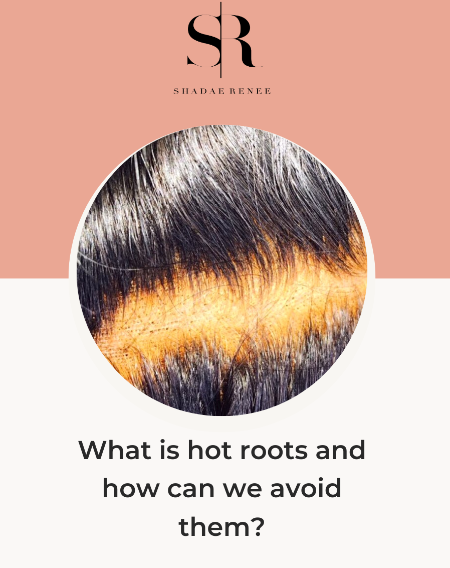What is hot roots on a frontal and how can we avoid them? – Shadae ...